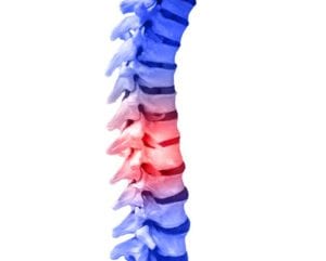 Nerve Root Block - LA Orthopedic & Pain Center