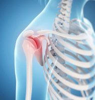 Shoulder Instability - LA Orthopedic & Pain Center