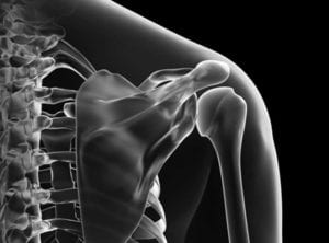 Shoulder Instability - LA Orthopedic & Pain Center