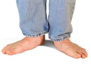 Surgical Flat Foot Correction - LA Orthopedic & Pain Center
