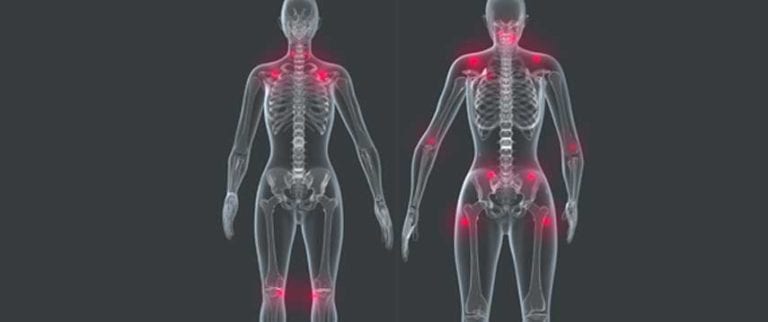 Trigger Point Injection - LA Orthopedic & Pain Center