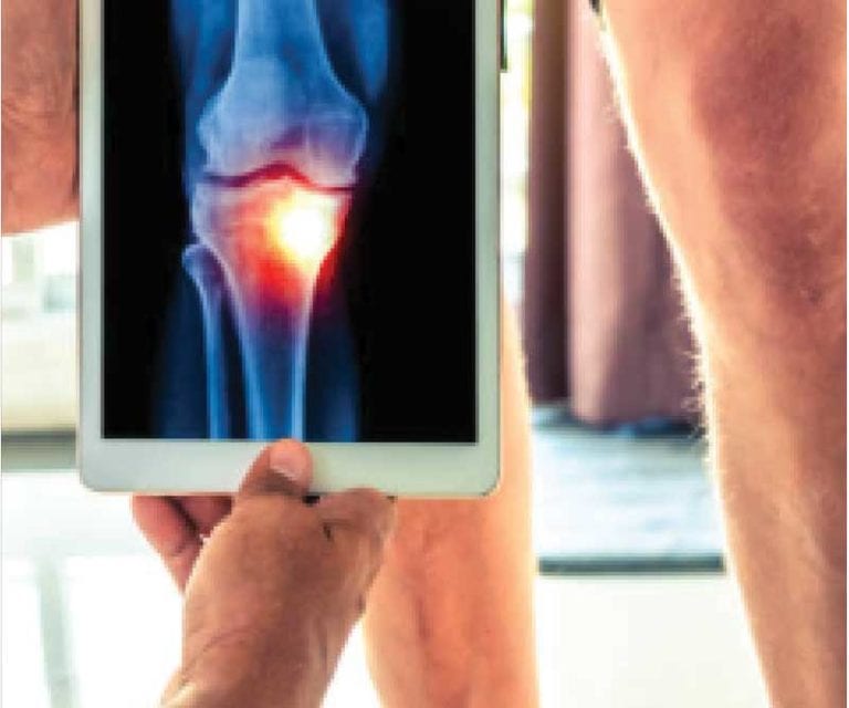 Knee Surgery - LA Orthopedic & Pain Center